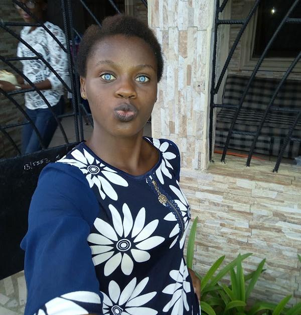 Meet Black Girl With Beautiful Blue Eyes You Wont Believe What